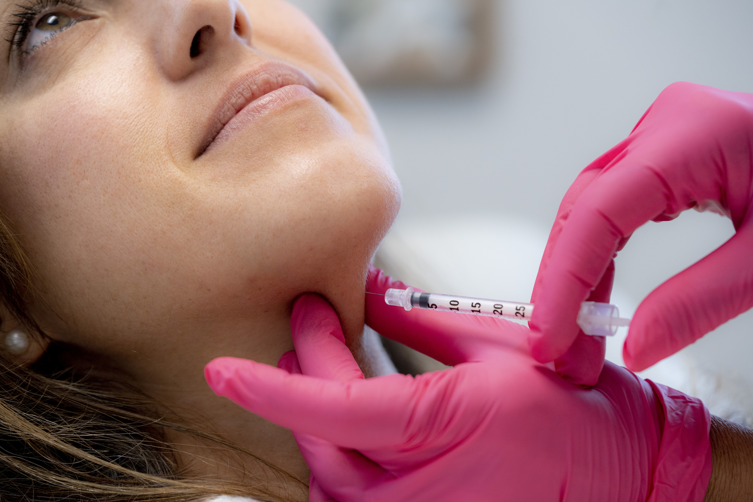 Kybella Injections for Double Chin Reduction in Gainesville, FL